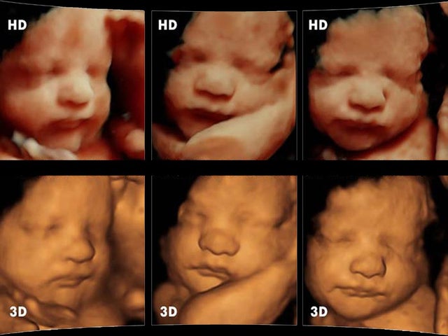 24 weeks 4d scan